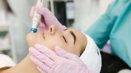 Dermapen - efekty mówią same za siebie. Jak długo się utrzymują?