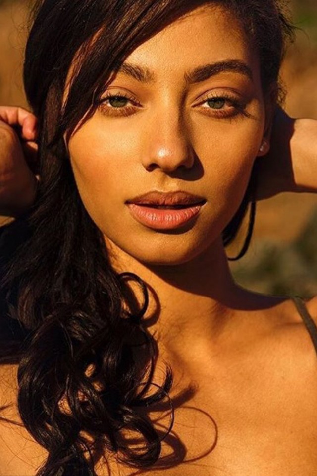 Felépült a rákból ez a 21 éves modell, és most újra a kifutóra állt ...