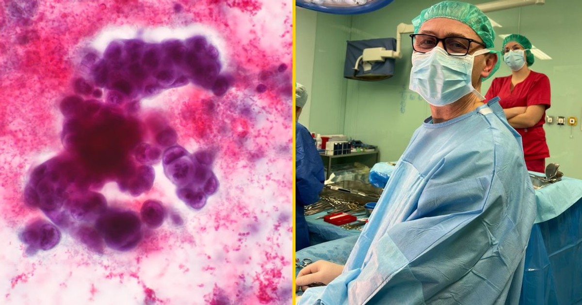 Jak zaczyna się rak? Prof. Hać: tak wygląda początek, zawsze