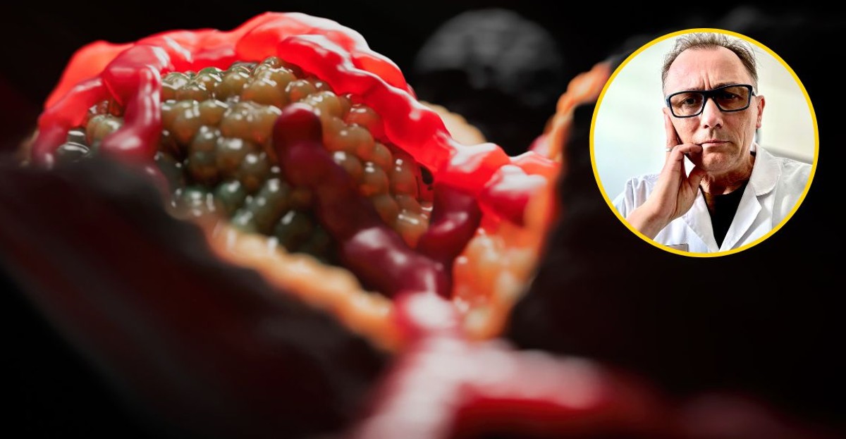 Dlaczego rak trzustki tak szybko zabija? Prof. Hać: fatalna kombinacja