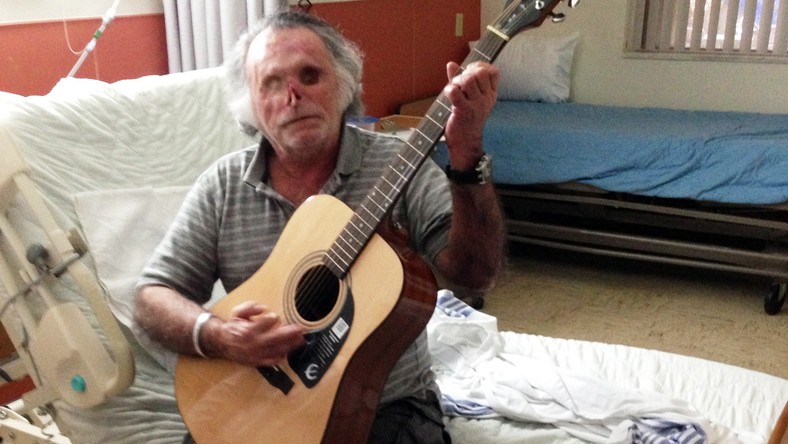 Ofiara "Kanibala z Miami" rok po napaści - Zdrowie