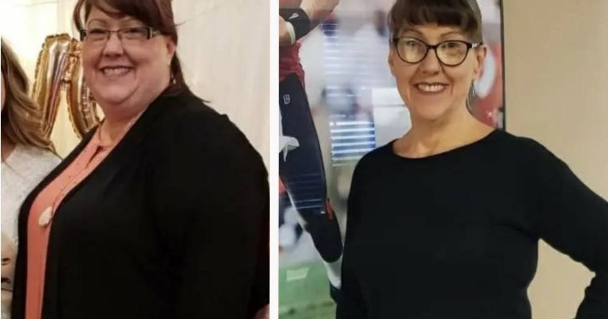 A woman lost 176 pounds taking Ozempic competitor Mounjaro. She's ...
