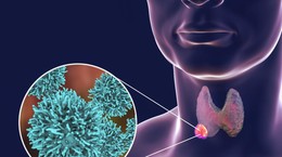 Biopsja - wskazania, rodzaje. Jak przygotować się do biopsji?