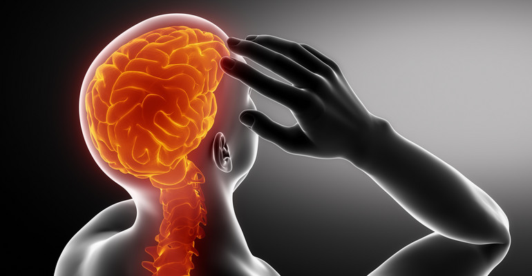 Migrena na wakacjach. Jak poradzić sobie z migreną podczas podróży czy wyjazdu wakacyjnego?