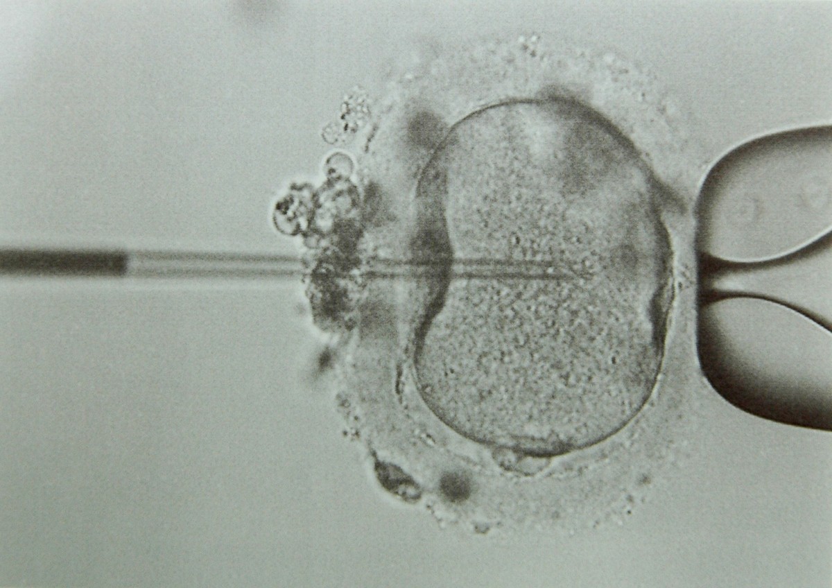 In Vitro w Polsce. Kliniki in vitro. Rynek leczenia niepłodności w ...