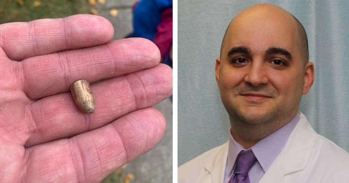 A psychiatrist who survived two gunshot wounds shares how it felt and ...