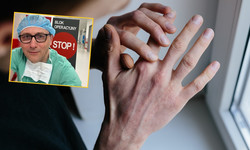 Jak boli rak? Prof. Hać o dwóch sygnałach. "Bezwzględnie objaw alarmowy"