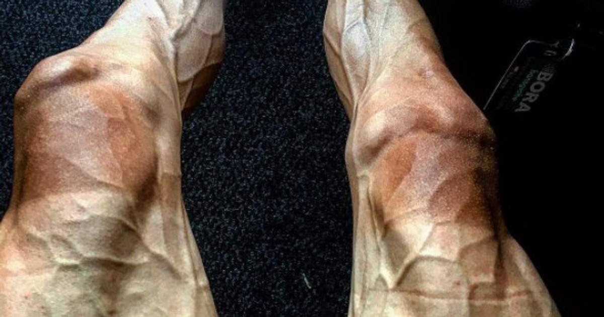 Wild photo shows Tour de France rider's vascular legs after 16 stages ...