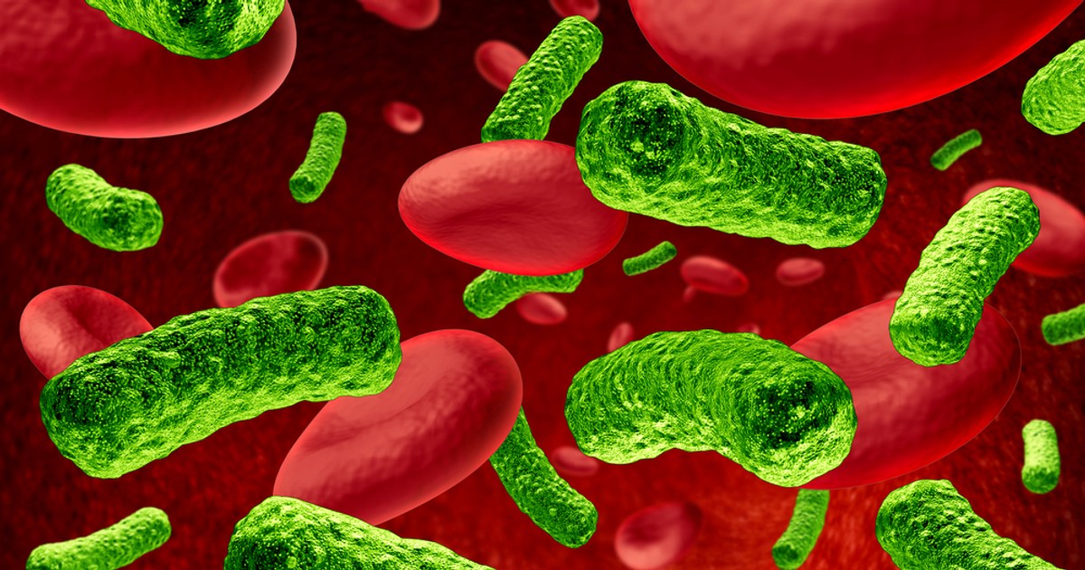 Sepsa (posocznica), a bakteriemia - Dziecko