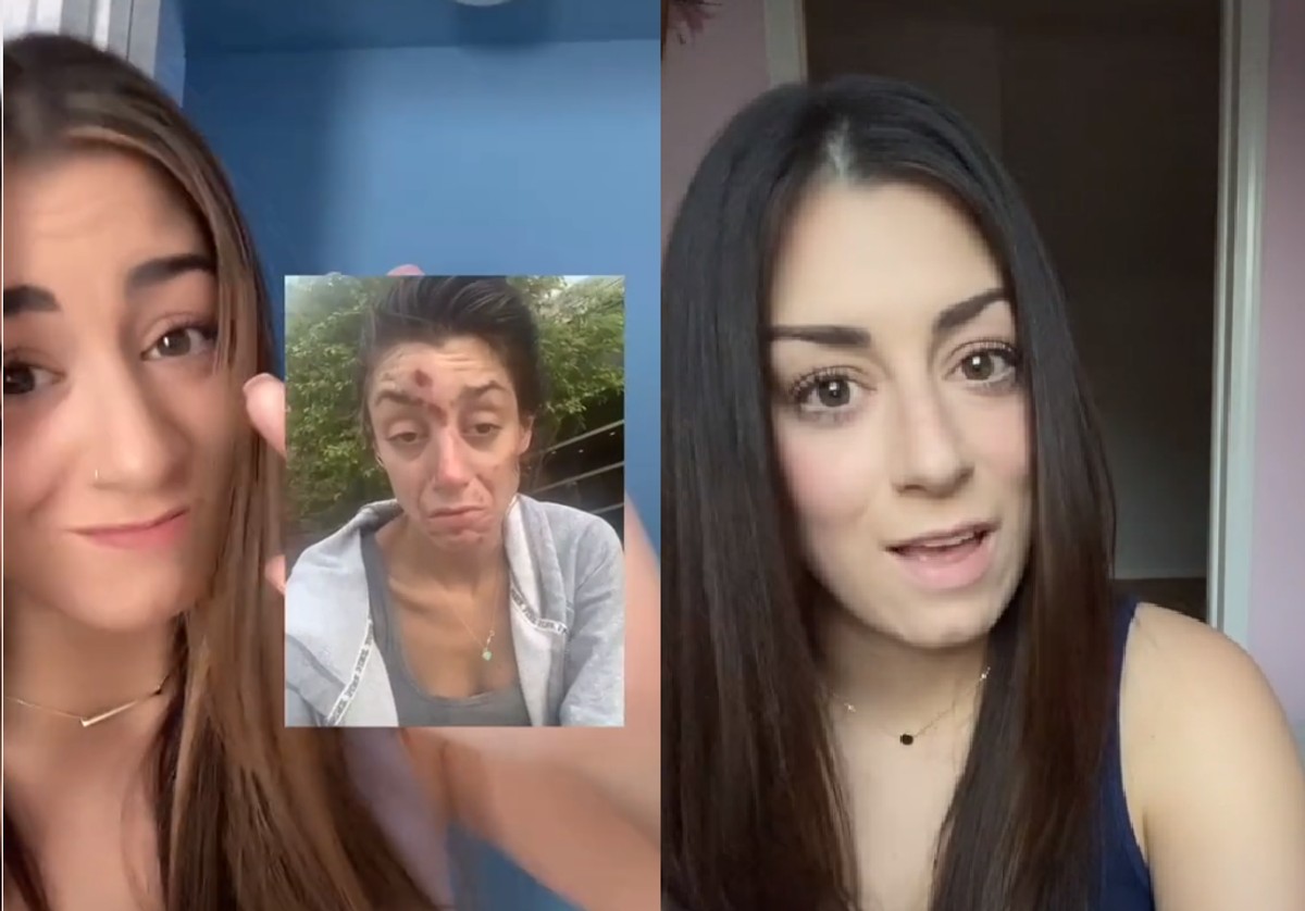 Od droge koju je prvi put probala sa 13 godina imala je rane po licu ...