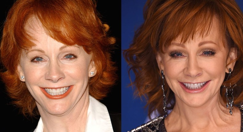 THEN AND NOW: The most iconic country stars of all time | Business ...