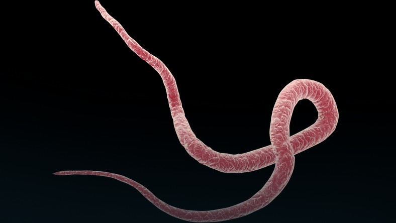 Glista ludzka (Ascaris lumbricoides) - objawy i leczenie u dzieci - Zdrowie