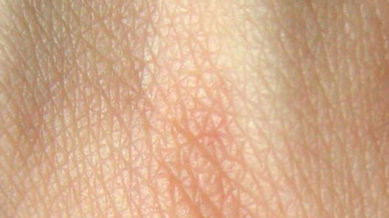 Skóra z drukarki 3D ułatwi przeszczepy - Technowinki