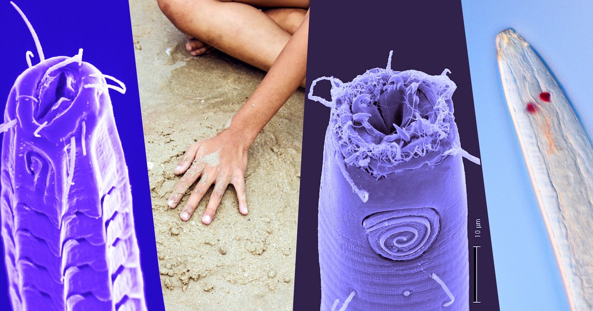 Creepy photos reveal the microscopic world of parasitic creatures ...