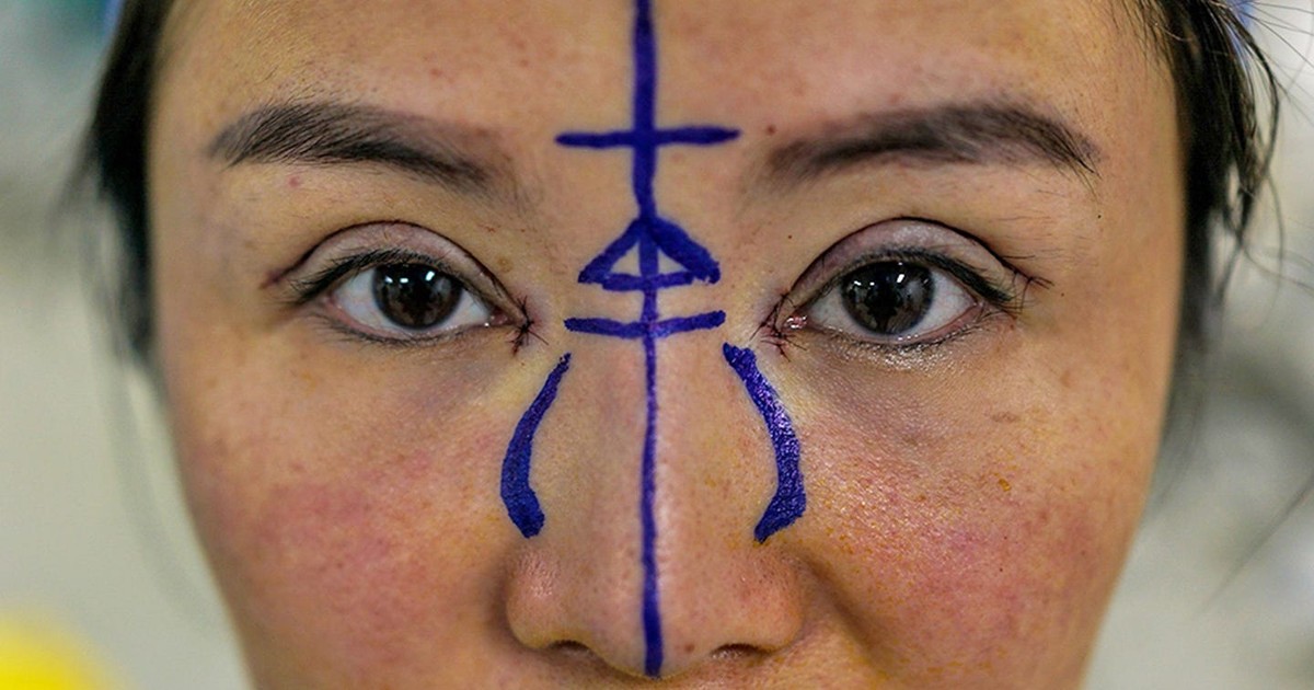 The fake doctors behind Asia's cosmetic surgery boom | Business Insider ...