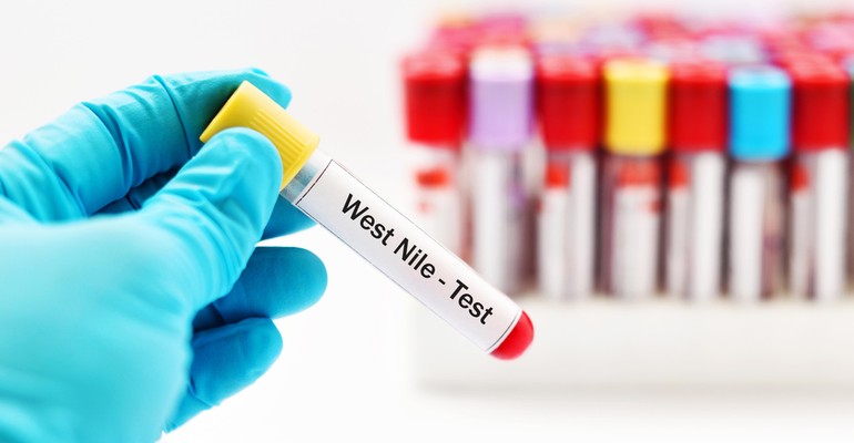 Zespół Westa - przyczyny, objawy, leczenie