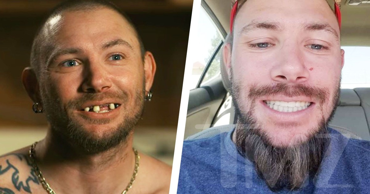 Here’s What 'Tiger King' Star John Finlay Looks Like With a New Set of ...