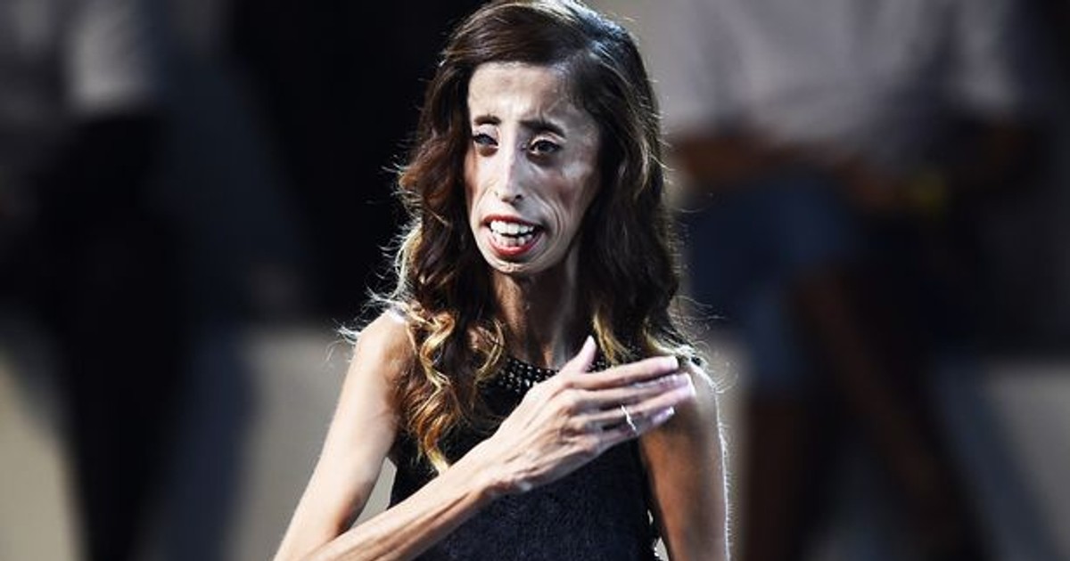 Meet the woman cruelly dubbed 'world's most ugliest' | Pulse Nigeria