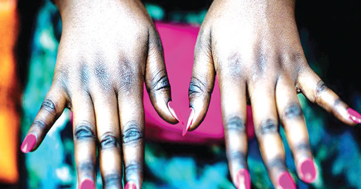 Top 7 African countries with the most skin bleaching population ...