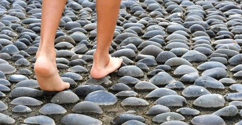 Platfus - przyczyny, objawy, leczenie. Ćwiczenia na platfusa