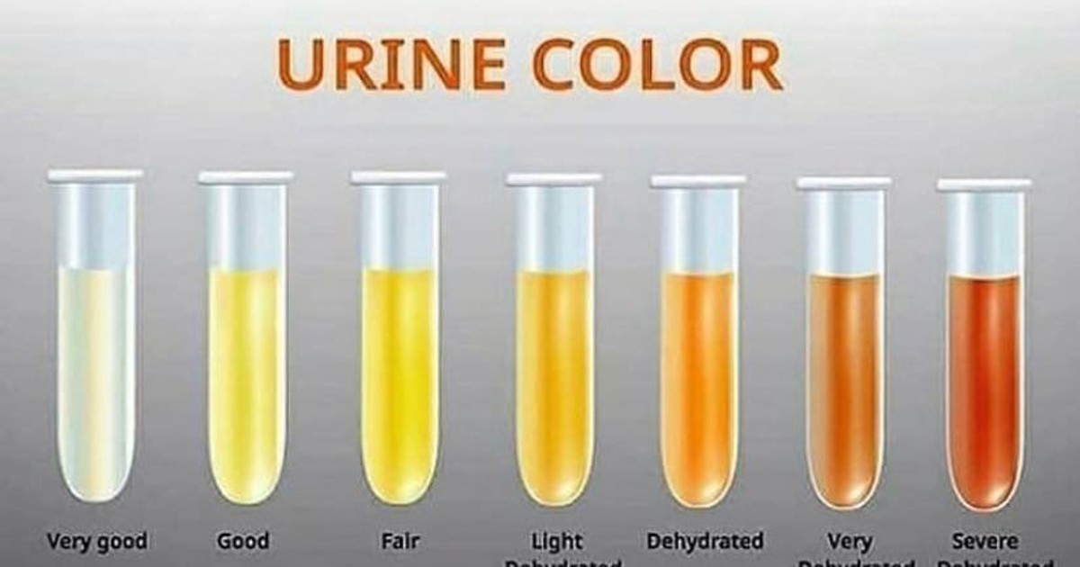Why does your urine change colour? | Pulse Ghana