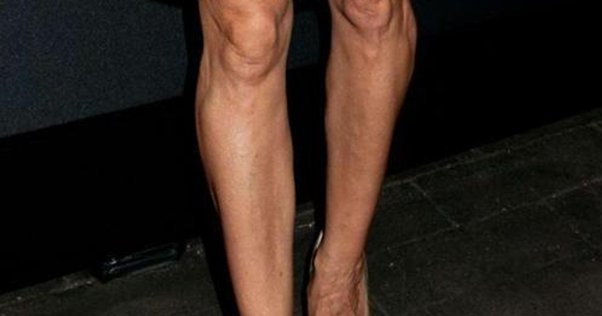 Sarah Jessica Parker: ikona mody ma zniszczone stopy - Film