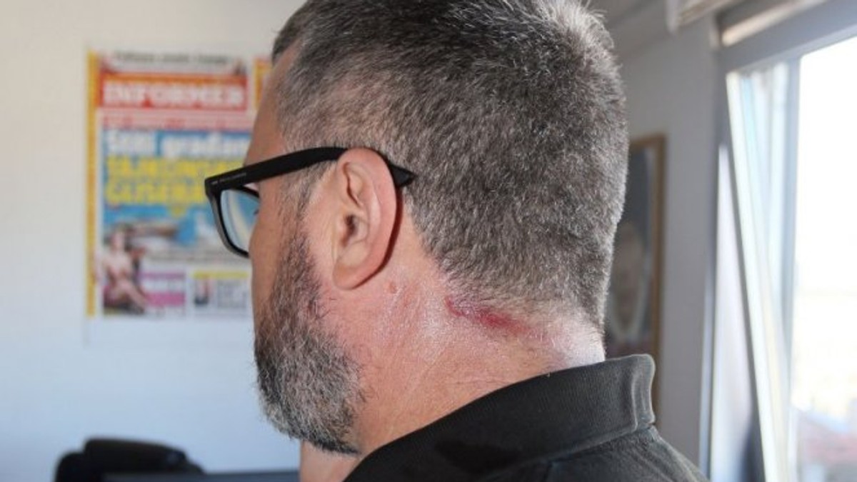 NAPADNUT GLAVNI UREDNIK INFORMERA Vučićevića udarili i vređali učesnici ...