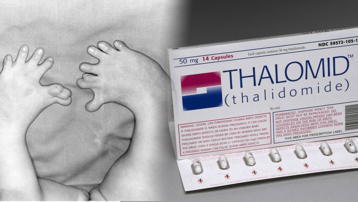 Australia przeprosi za "tragedię talidomidu". Lek zabił 4 tys. dzieci