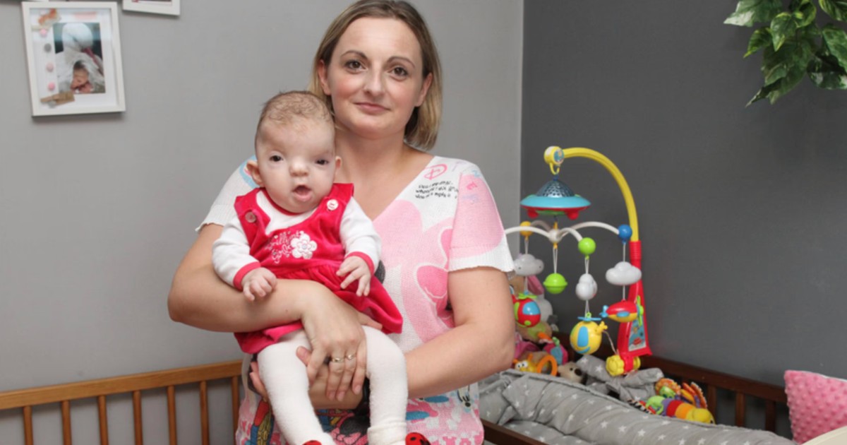 Nadia ma ciężką wadę genetyczną. Trzeba pilnie zrobić operację - Kobieta