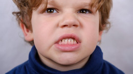 Progenia – wada, którą można wyleczyć