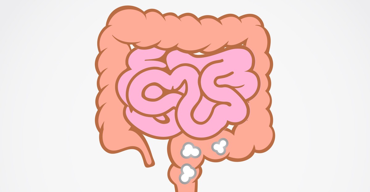 Zgorzel gazowa - objawy, leczenie