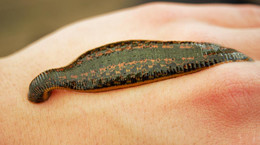 Pijawka medyczna - zastosowanie, wykorzystanie, przeciwwskazania. Co ...