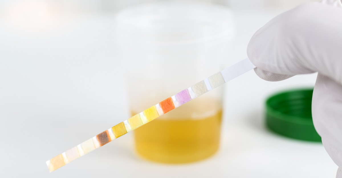 Czy Bakteria Escherichia Coli W Moczu To Oznaka Choroby Diagnostka Wyjaśnia
