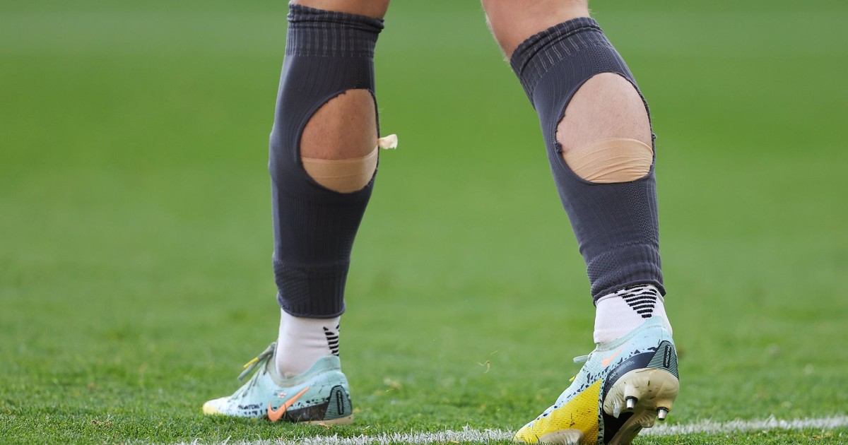 Why do so many footballers cut holes in their socks? | Pulse Nigeria Why do so many footballers cut holes in their socks? | Pulse Nigeria