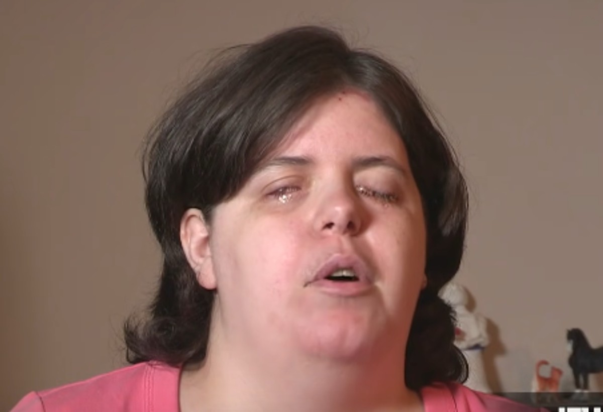 Sipala je kiselinu u oči da bi ostala slepa: Ima ovaj poremećaj ...