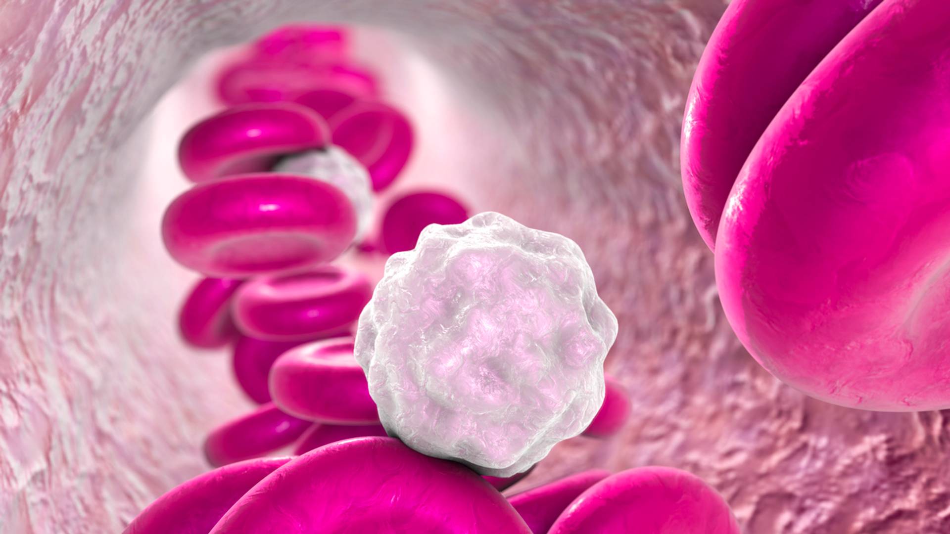 Neutrofile: NORMY. Co oznacza podwyższony lub obniżony stan neutrofili ...