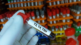 Badanie anty TPO - jak się przygotować? Normy anty TPO