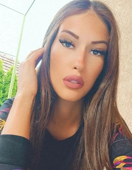 Sandra Meduza se izoperisala do neprepoznatljivosti: Evo kako izgleda ...