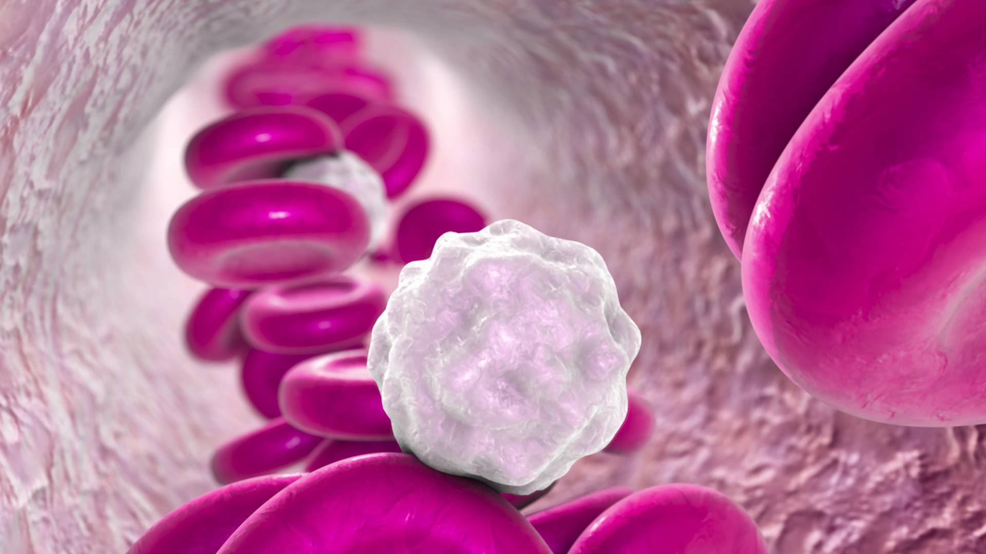 Neutrofile: NORMY. Co oznacza podwyższony lub obniżony stan neutrofili ...