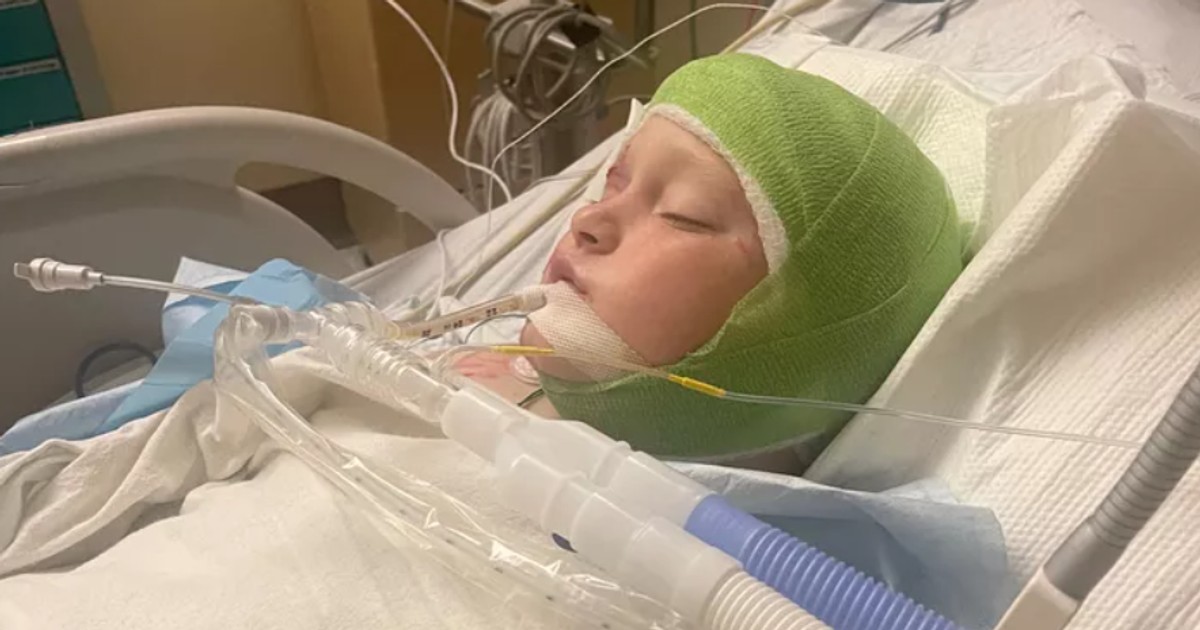 Psy pogryzły 11-latka. Stracił 70 proc. skóry głowy - Wiadomości