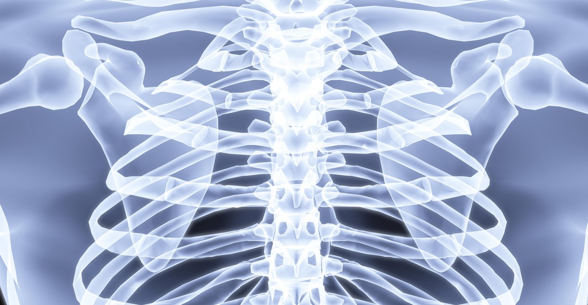 Żebra - anatomia, funkcje, choroby. Przyczyny bólu żeber