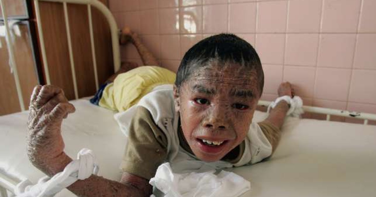 10 scariest body deformations | Pulse Nigeria