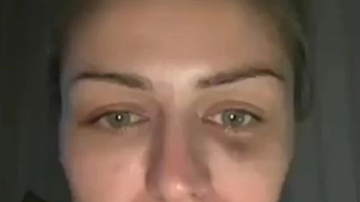 Modrice, podlivi na telu i posekotine: Sandra Obradović tvrdi da joj je ...