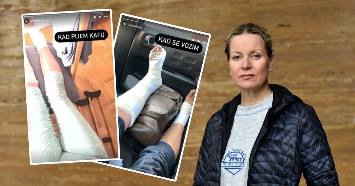 Glumica Aleksandra Janković povredila obe noge, pa slikala zavoj, gips ...