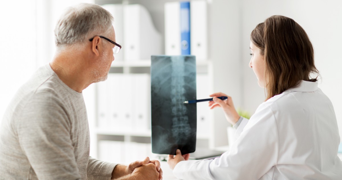 Osteofity - dzioby kostne tworzące się na krawędziach trzonu kręgosłupa ...