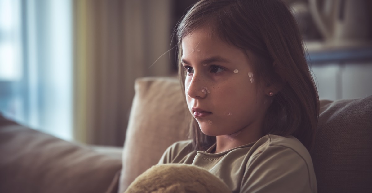 Jak wygląda ospa? Lekarka wyjaśnia objawy