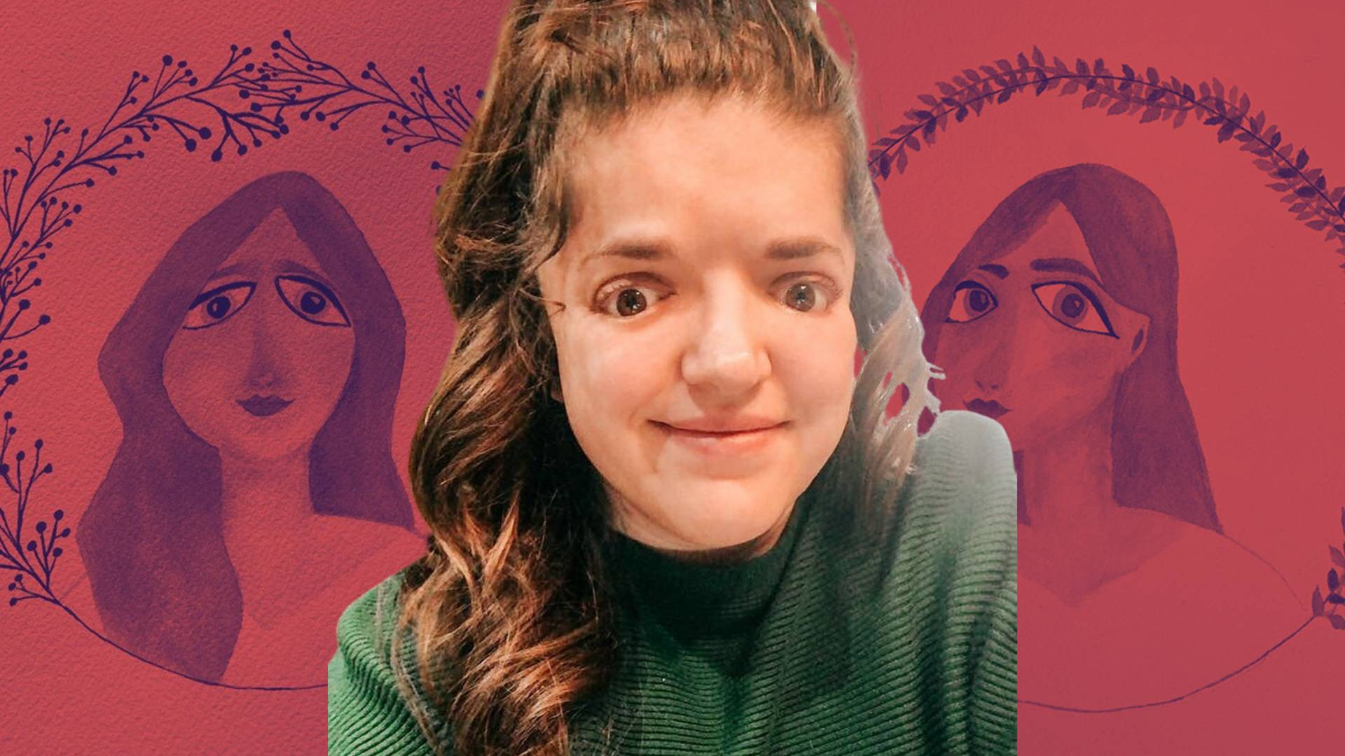 Zespół Crouzona: na czym polega choroba Ariel Henley i Ewy Mazurek ...