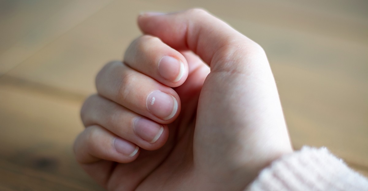 Takie przebarwienia na paznokciach to sygnał, by odwiedzić specjalistę