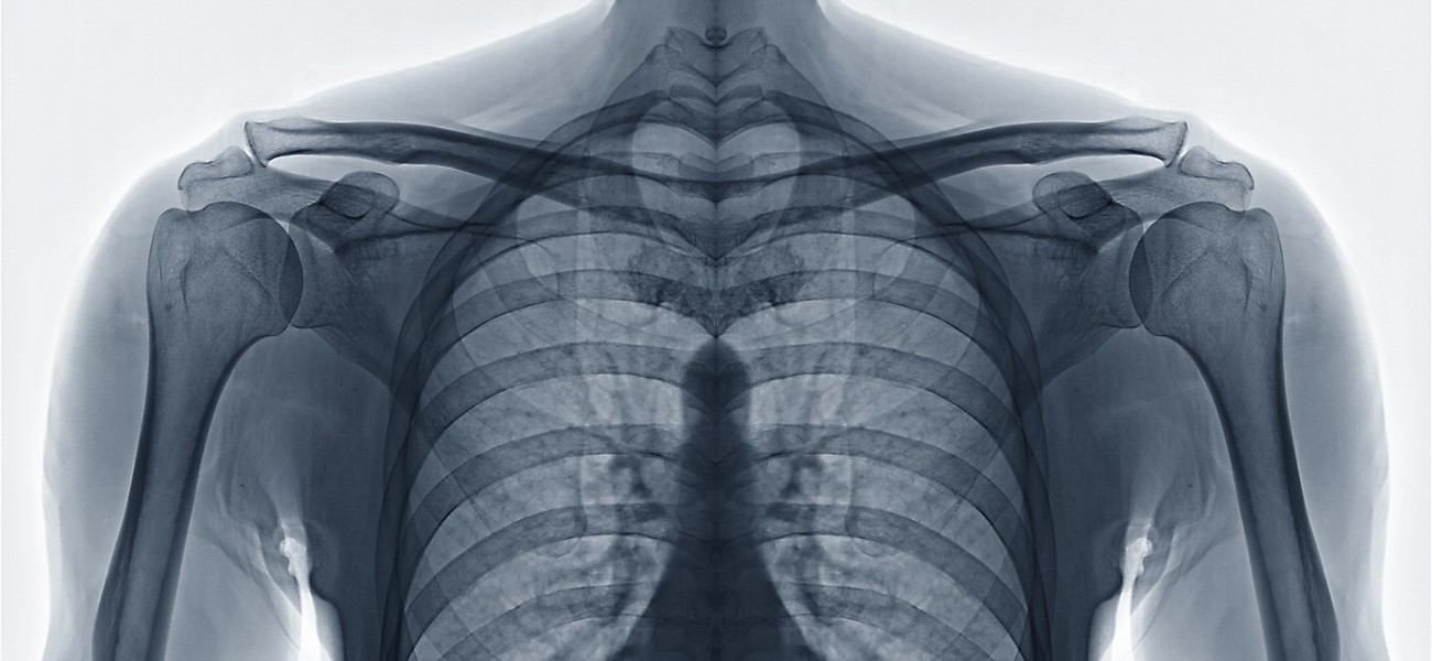 Żebra – u człowieka, budowa, co oznacza ból?