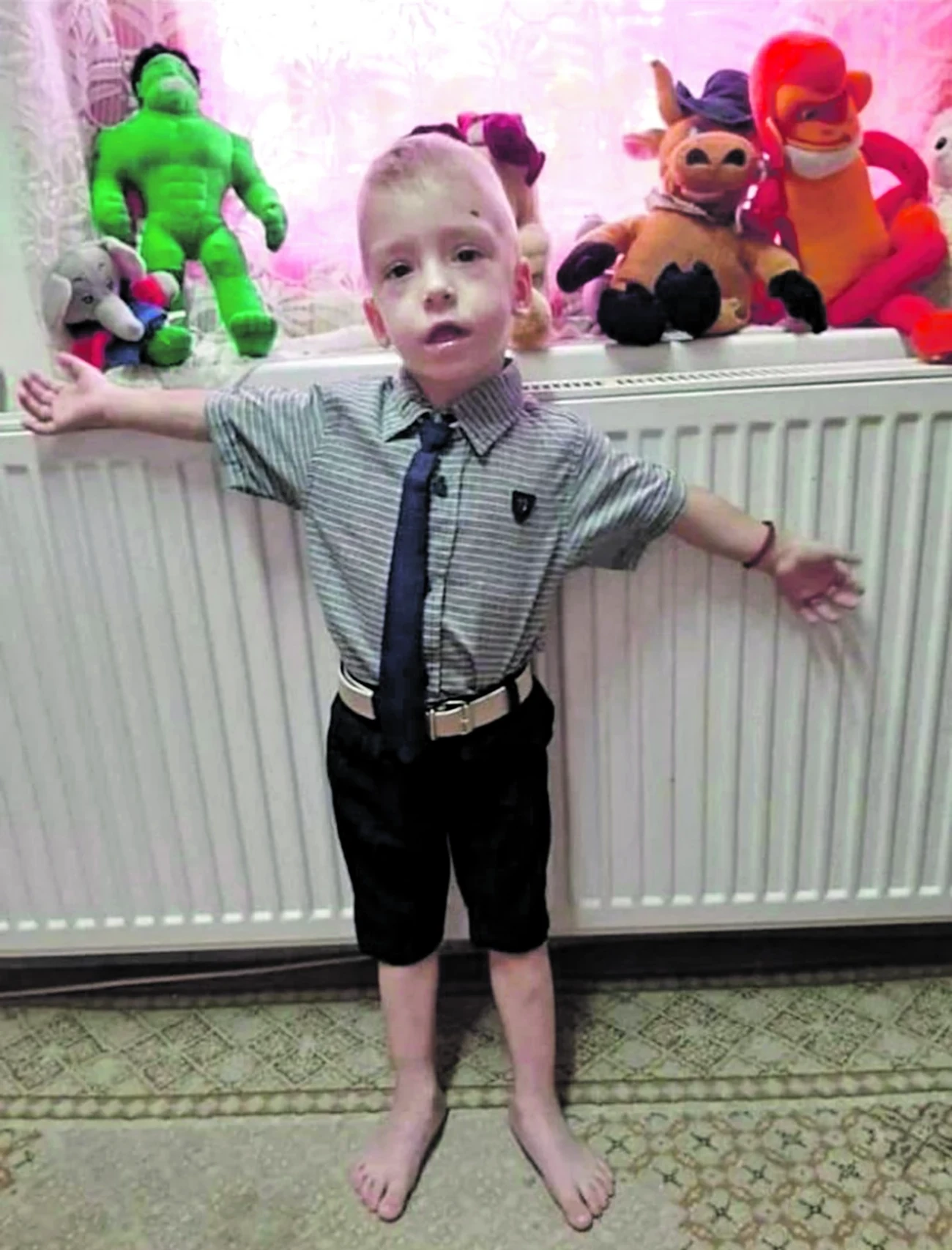 Leo (5) ima dva retka sindroma i probleme sa bubrezima, vidom, sluhom ...